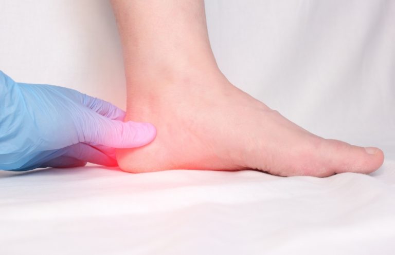 Espolón: Tratamiento espolón calcáneo pie - Láser terapia Moral